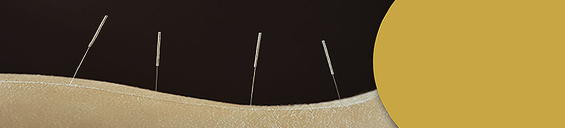 Eastern Healing Acupuncture Clinic - Orleans, On. Acupuncture